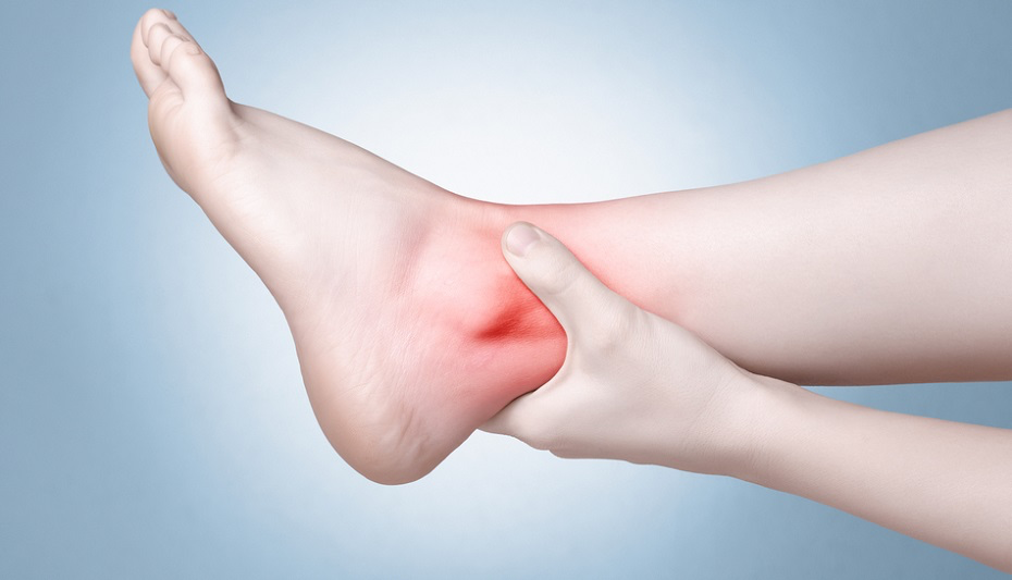 Achilles Tendinopathy - Elevate Physiotherapy & Sports Injury Clinic
